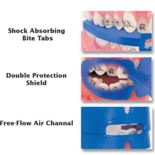 Ultra-Guard Double Mouthguard Clear (Protection for Upper & Lower teet ...